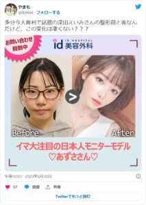 【300万で手にした第2の人生】深田えいみの整形前が全然違う！本人の「コンプレックスは直すもの」が素敵すぎる！ | 芸能人のあの噂